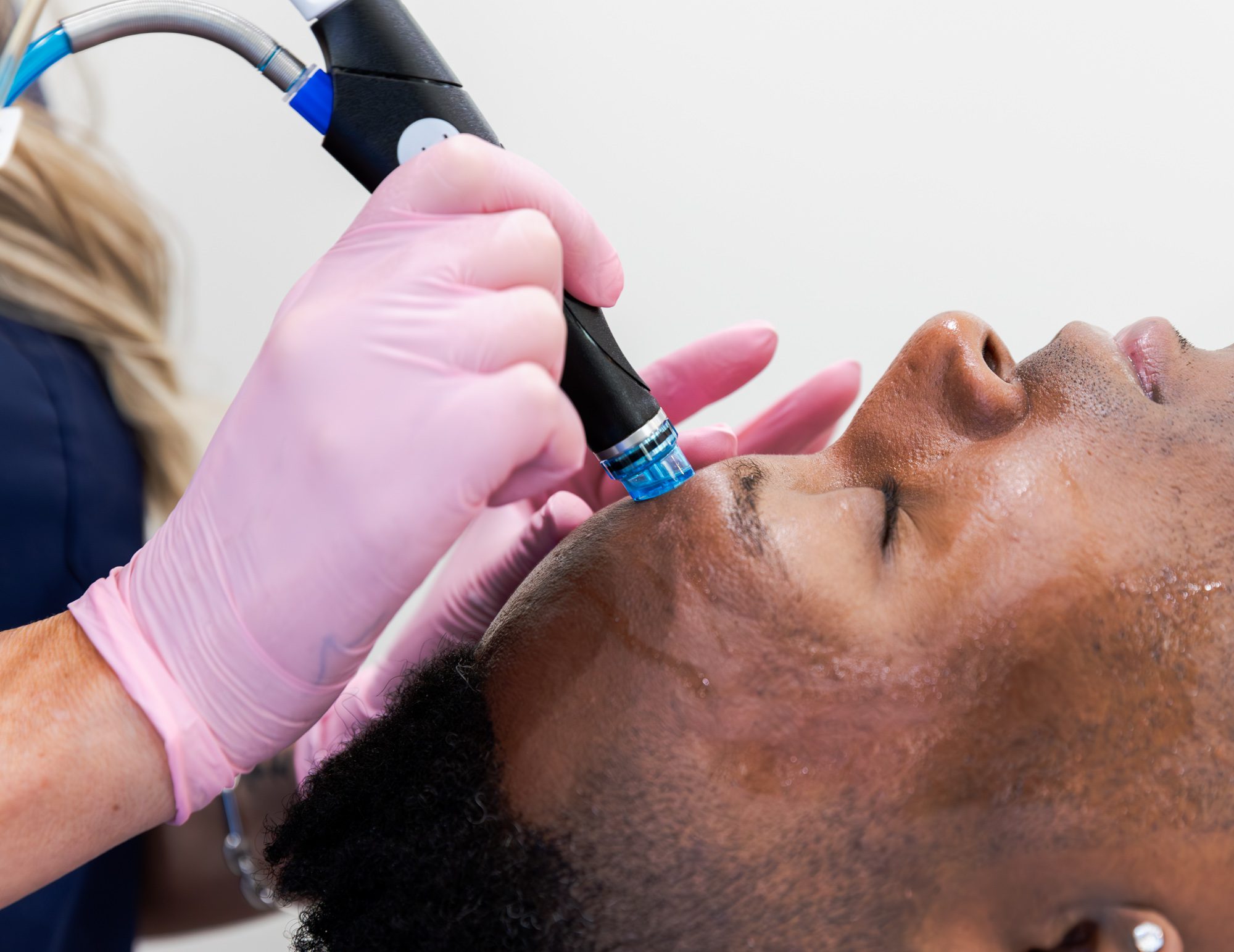 Hydrafacial in Frederick | Transformed Aesthetic and Wellness Center